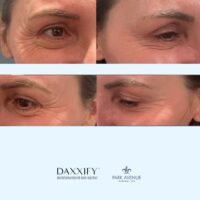 Before & After Gallery | Park Avenue Medical Spa